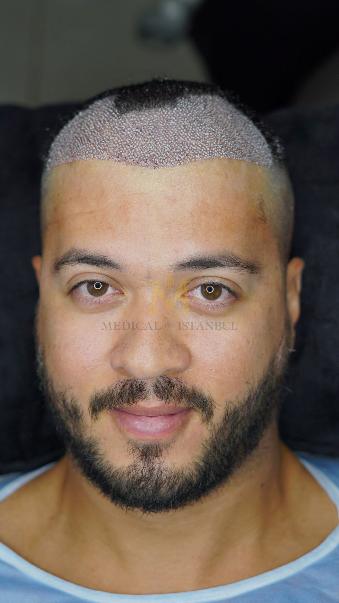sihairtransplant Transplant Hospital